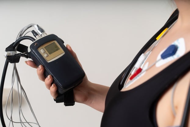 Holter de 24 Horas: Qué Debes Saber